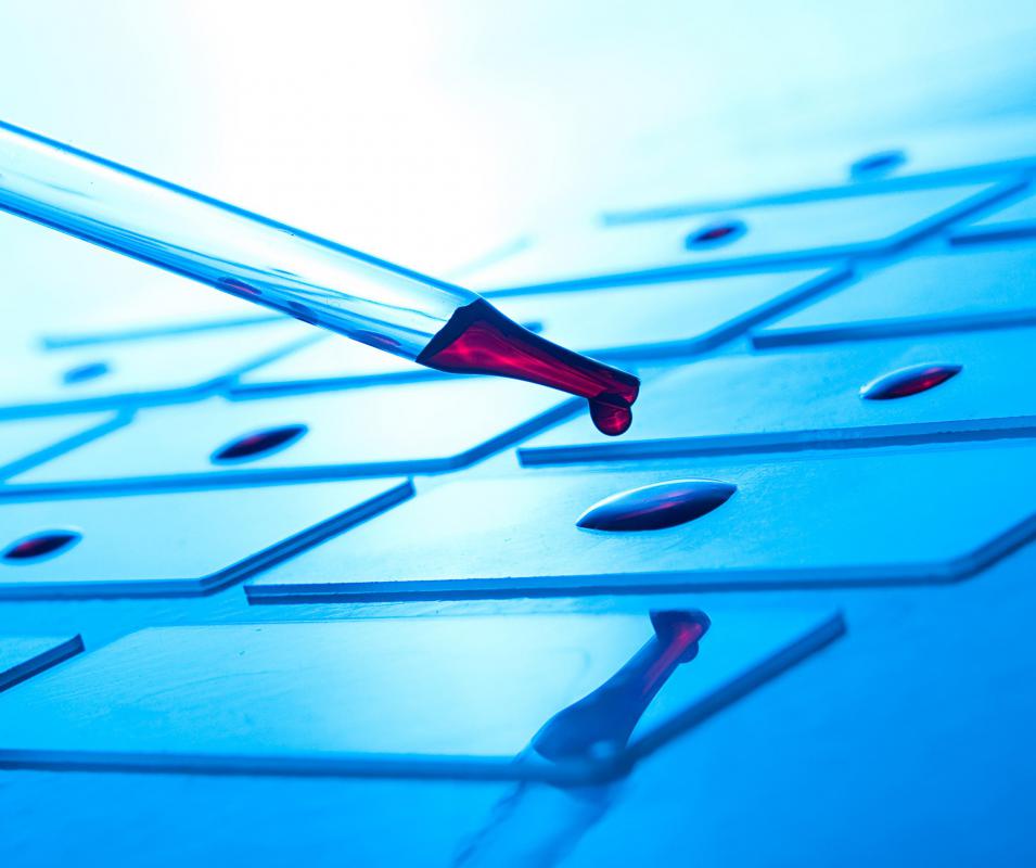 What is Clinical Biochemistry? (with pictures)