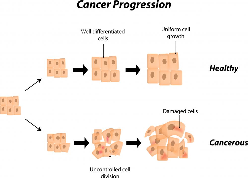 What is an Extracellular Matrix? (with picture)