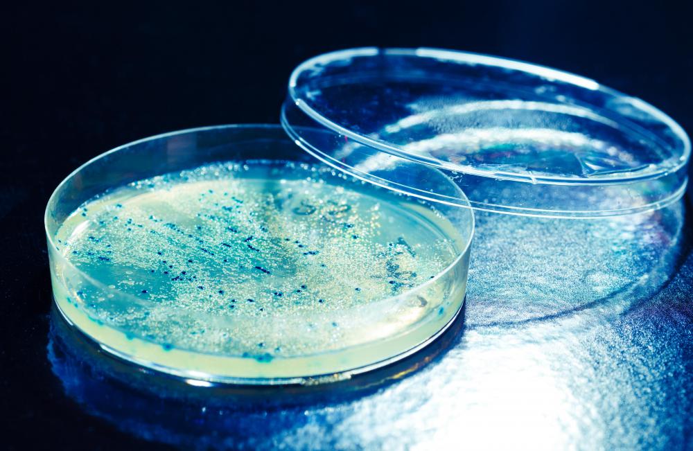What are the Different Methods of Bacterial Detection?