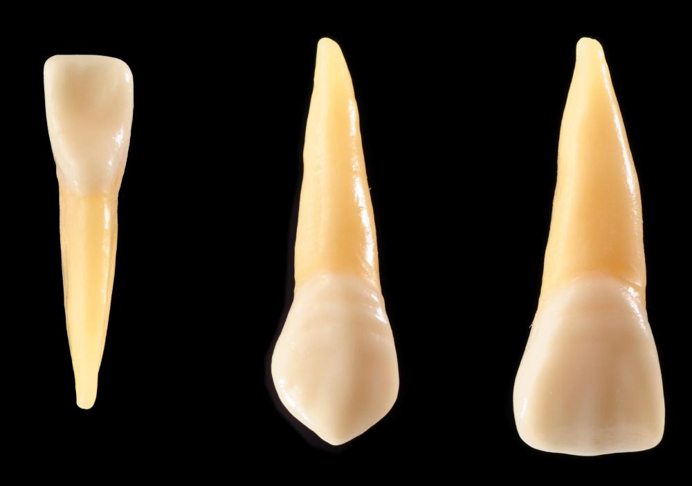 What is Demineralization? (with pictures)