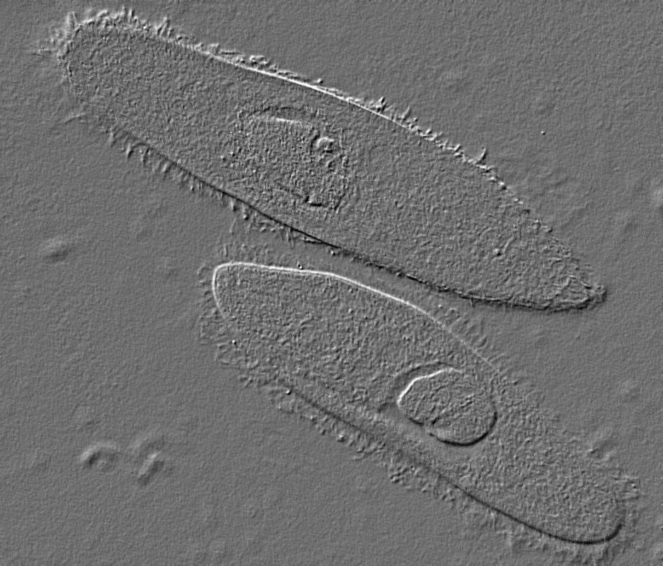 What are Some Common Microscopic Animals? (with pictures)